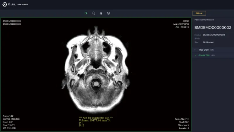 EIRL Brain Metry｜HAIPカタログサイト