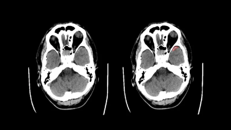 EIRL Brain Segmentation｜HAIPカタログサイト