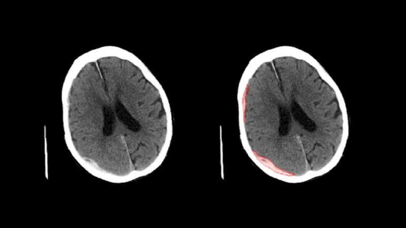 EIRL Brain Segmentation｜HAIPカタログサイト